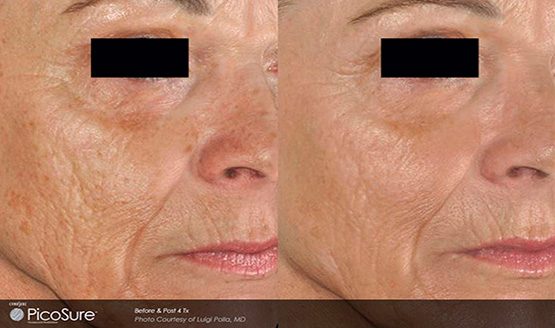 Celebrate Mom at Vada - Vada Spa: New York City's Easiest Spa