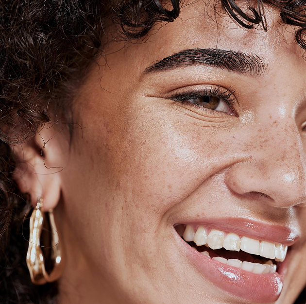 LaseMD Ultra™ OLD - Vada Spa: New York City's Easiest Spa